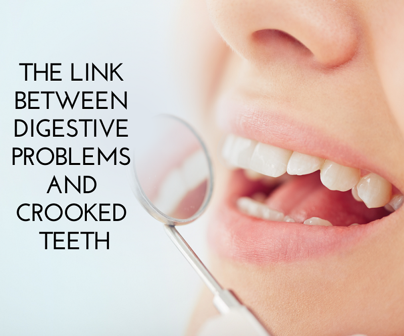 The Link Between Digestive Problems and Crooked Teeth | Dentist in San ...