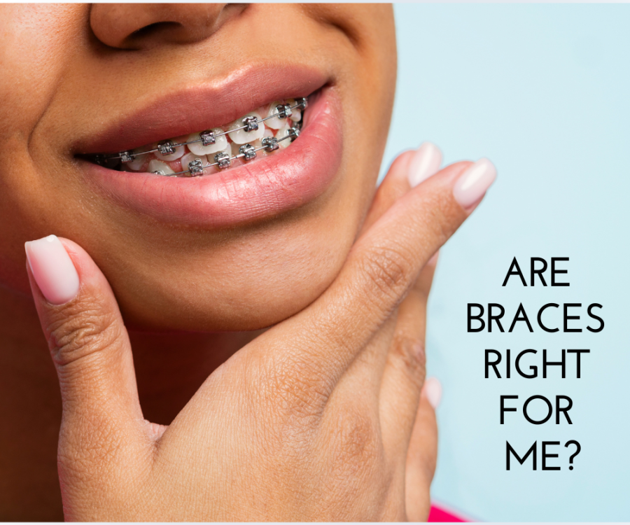 Are Braces Right for Me? | Dentist in San Ramon CA